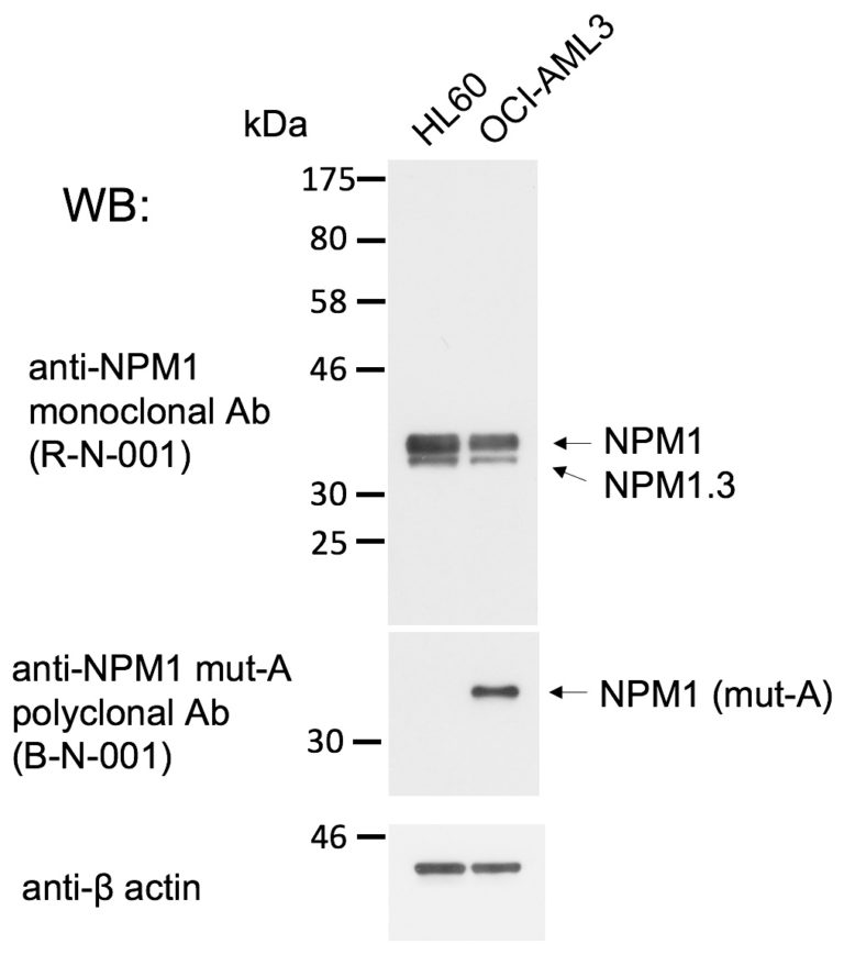 Human Nucleophosmin (NPM1) monoclonal antibody | マブプロテイン｜抗体製造 mAbProtein